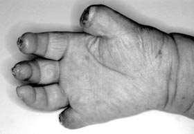 Japanese Society for Vascular Surgery