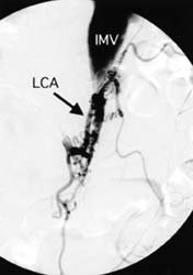 Japanese Society for Vascular Surgery