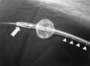 Japanese Society for Vascular Surgery